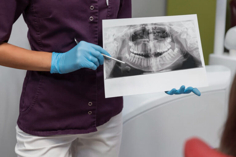 Orthopantomography. What it is, how it is done and what it is used for ...